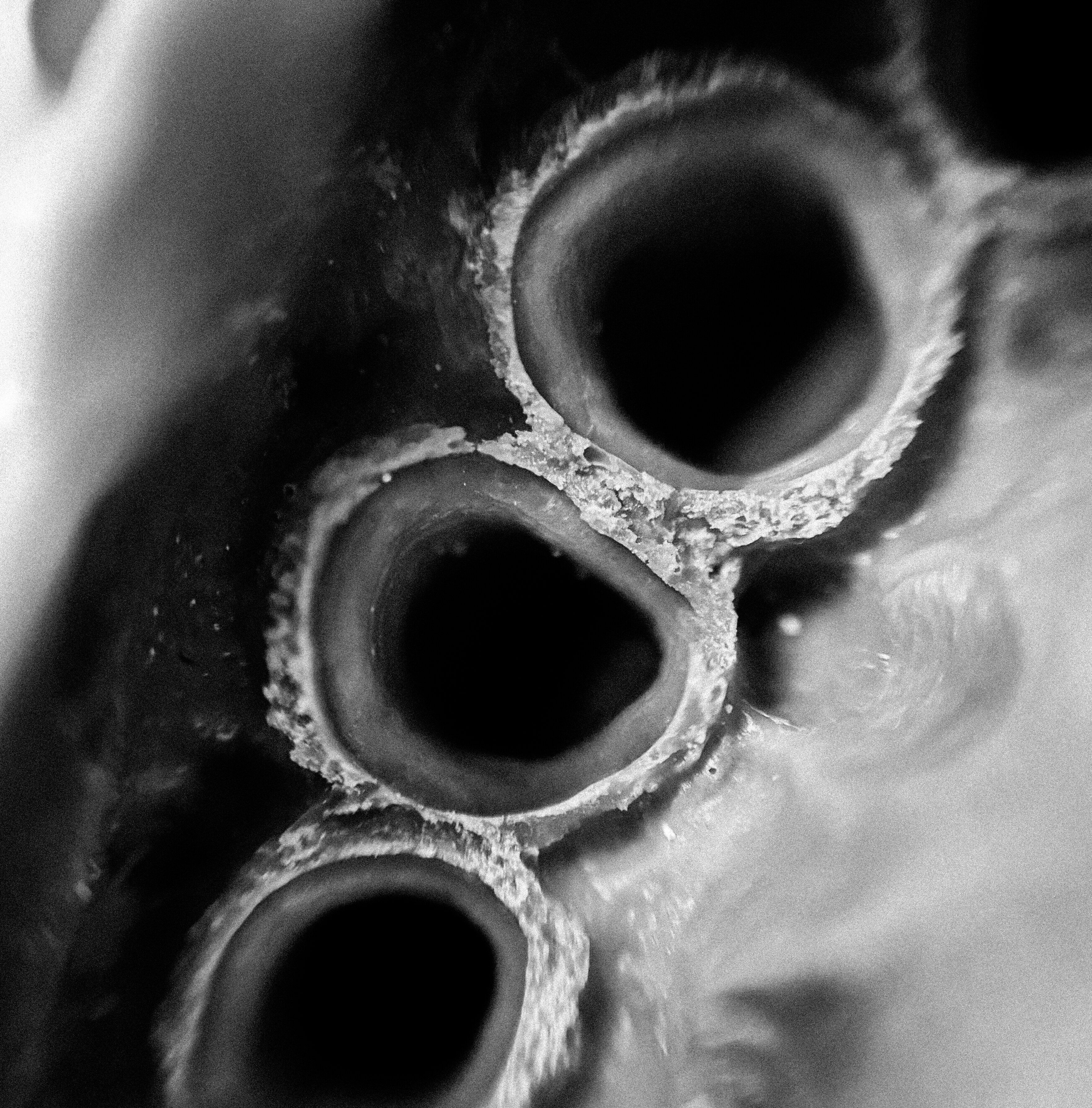 Crowns & Bridges | South Yarra Dental Group