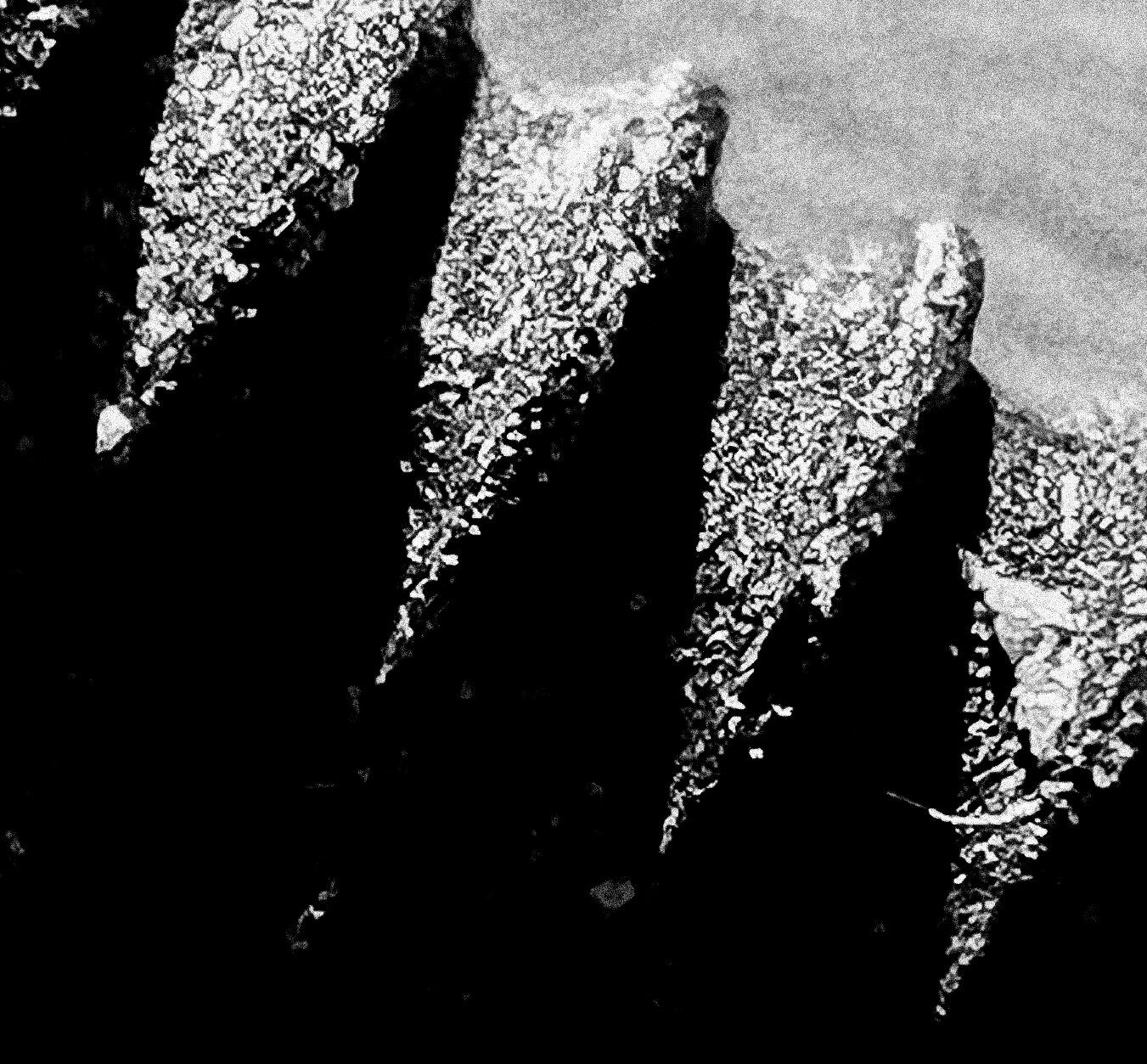 Dental Implants | South Yarra Dental Group