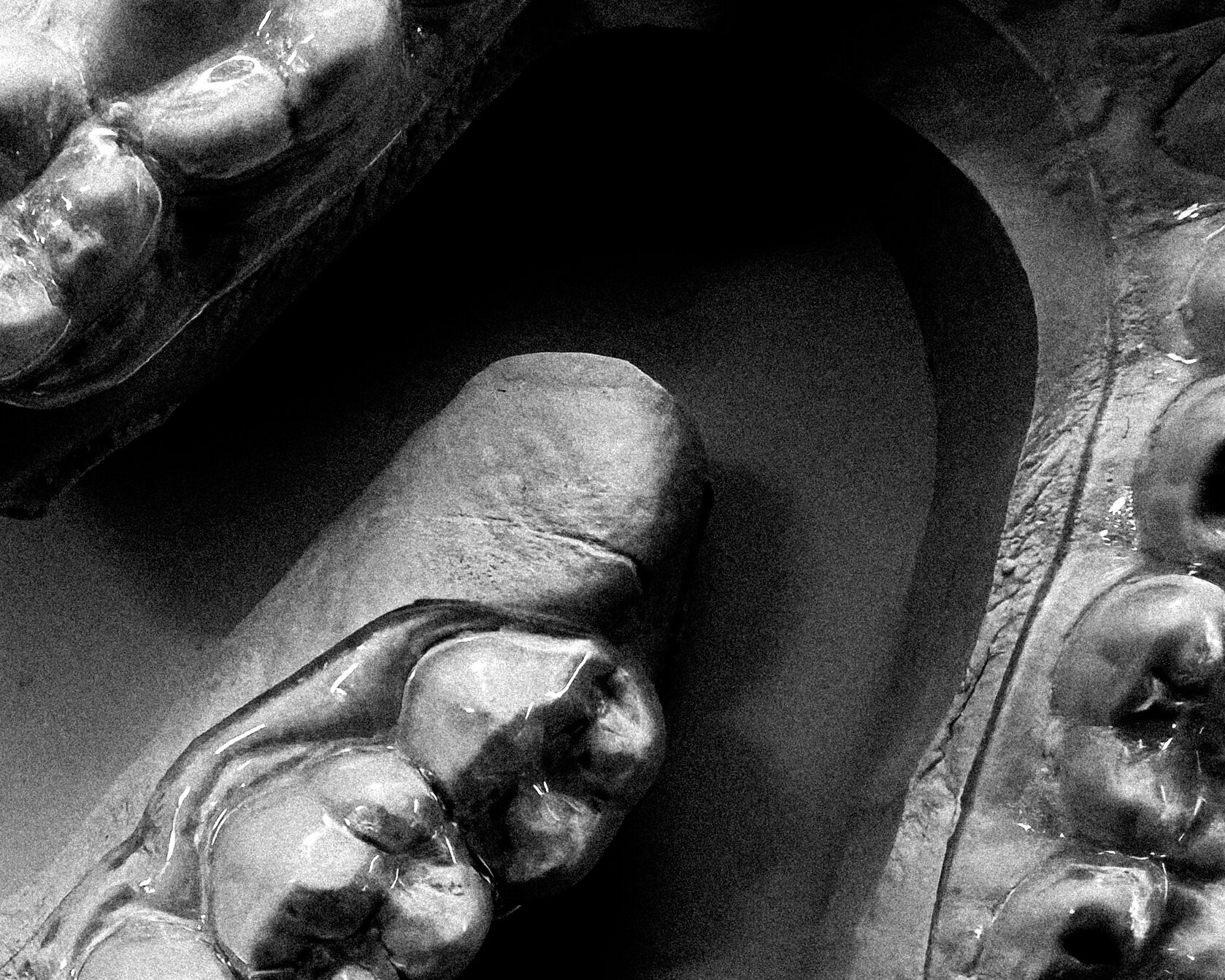 Hygiene & Gum Care | South Yarra Dental Group